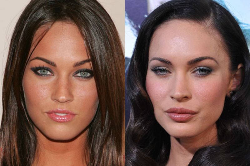 MEGAN FOX: 5 Schönheiten, die es mit Beauty-OPs übertrieben haben